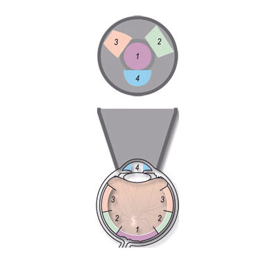 Goldmann 3-Mirror Lens - Infant – Optego Singapore